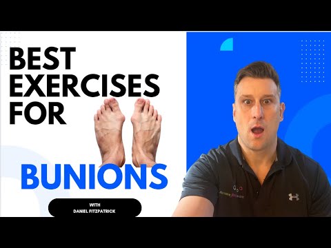 Bunion Exercises that we use with our treatment process - YouTube