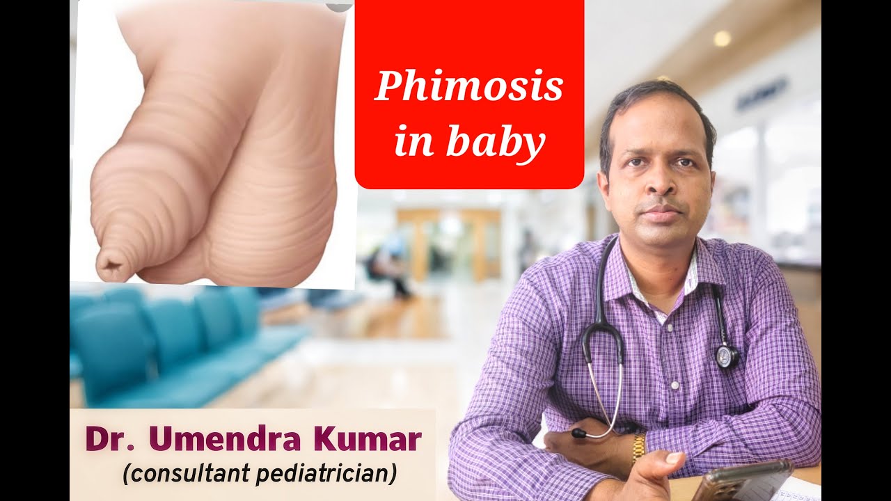 Phimosis in infant #YouTube video @DrUMENDRAKUMAR - YouTube