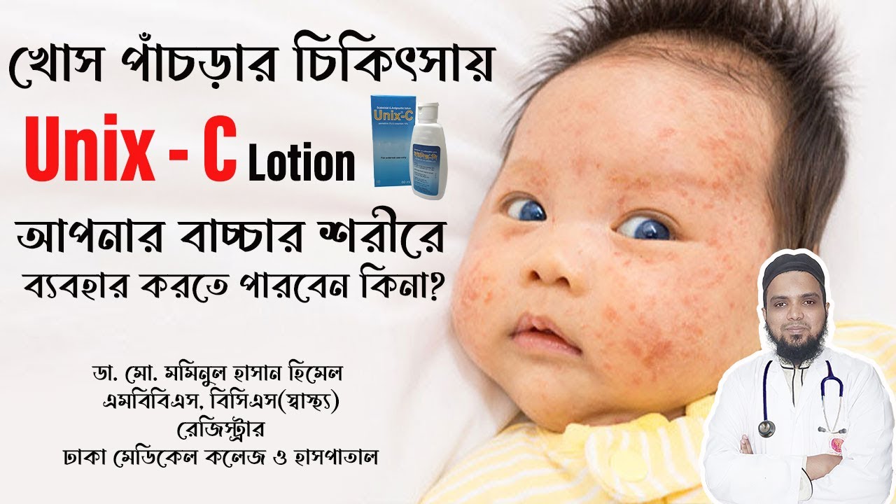 খোস পাঁচড়ার চিকিৎসায় Unix - C lotion আপনার বাচ্চার শরীরে ব্যবহার করতে ...