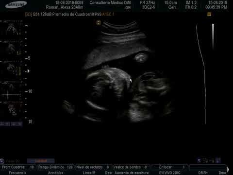 0615 06 Alexa Roman 3 - YouTube