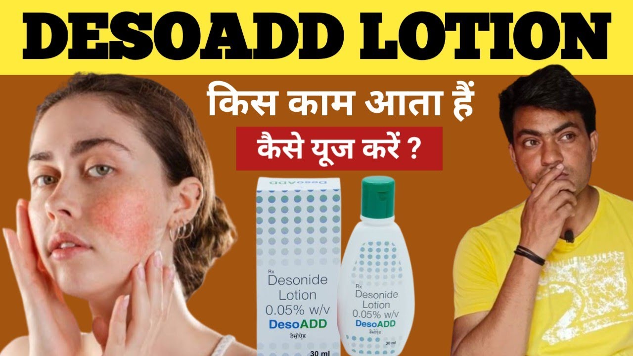 desoadd lotion | desoadd lotion uses in hindi | desoadd lotion kis kaam ...