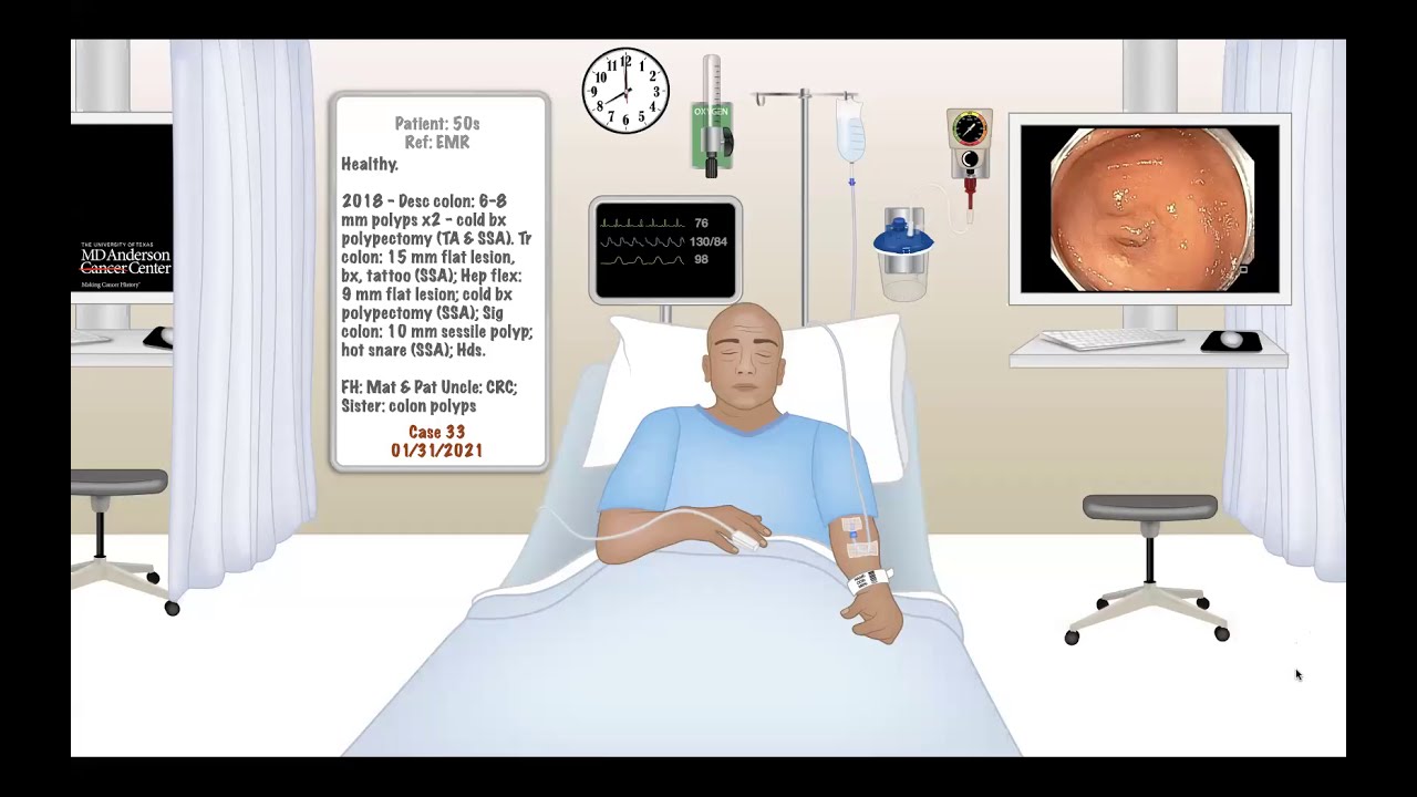 MDACC Endoscopy Refresher - Zoom 33 - Cecal SSA Resection - YouTube