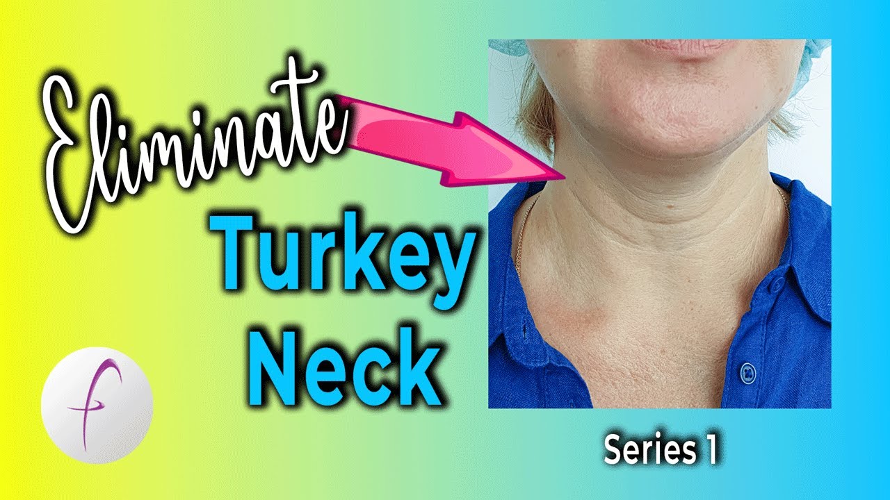 Do this Daily to Tighten & Tone TURKEY NECK and NECK LINES - YouTube