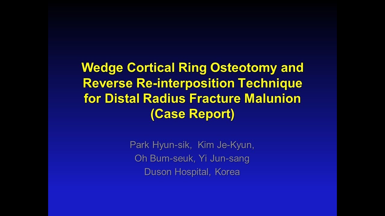 Wedge Cortical Ring Osteotomy Reverse Re-interposition Technique for ...