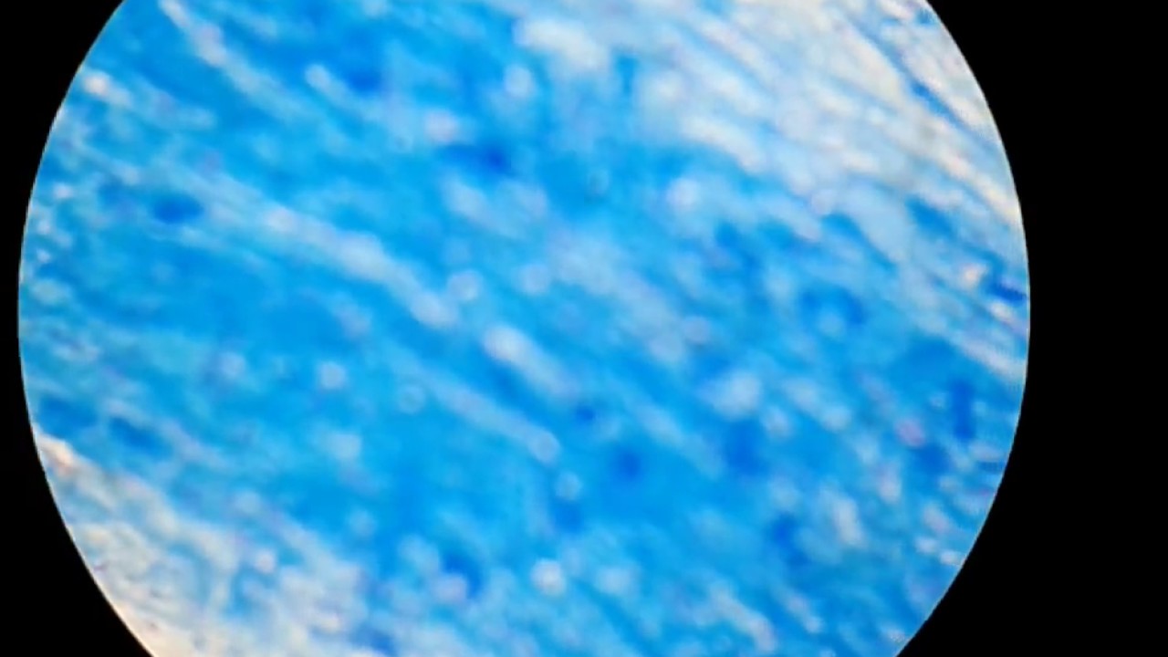 Baciloscopia Positiva (+++) Campo lleno 😊 - YouTube