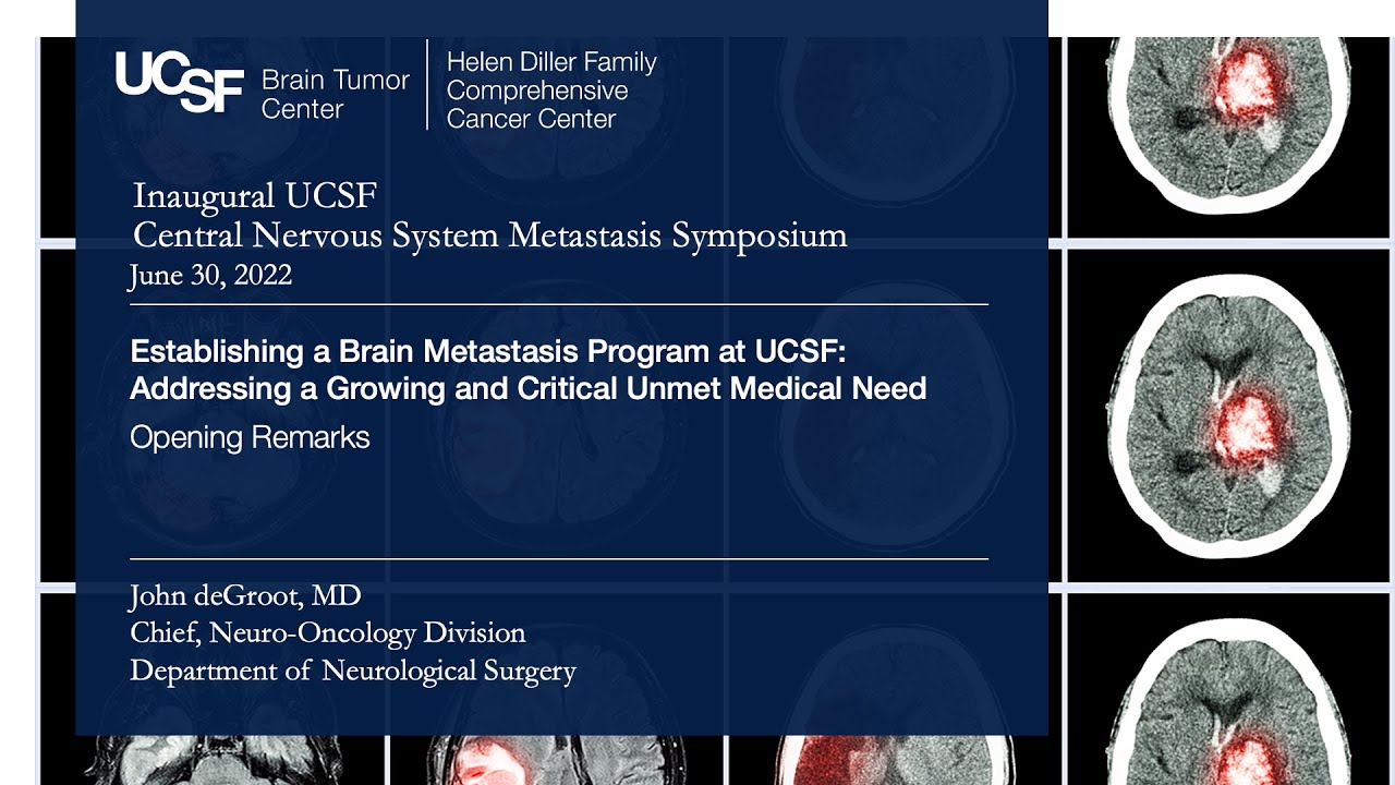 Establishing a Brain Metastasis Program at UCSF | John deGroot, MD ...