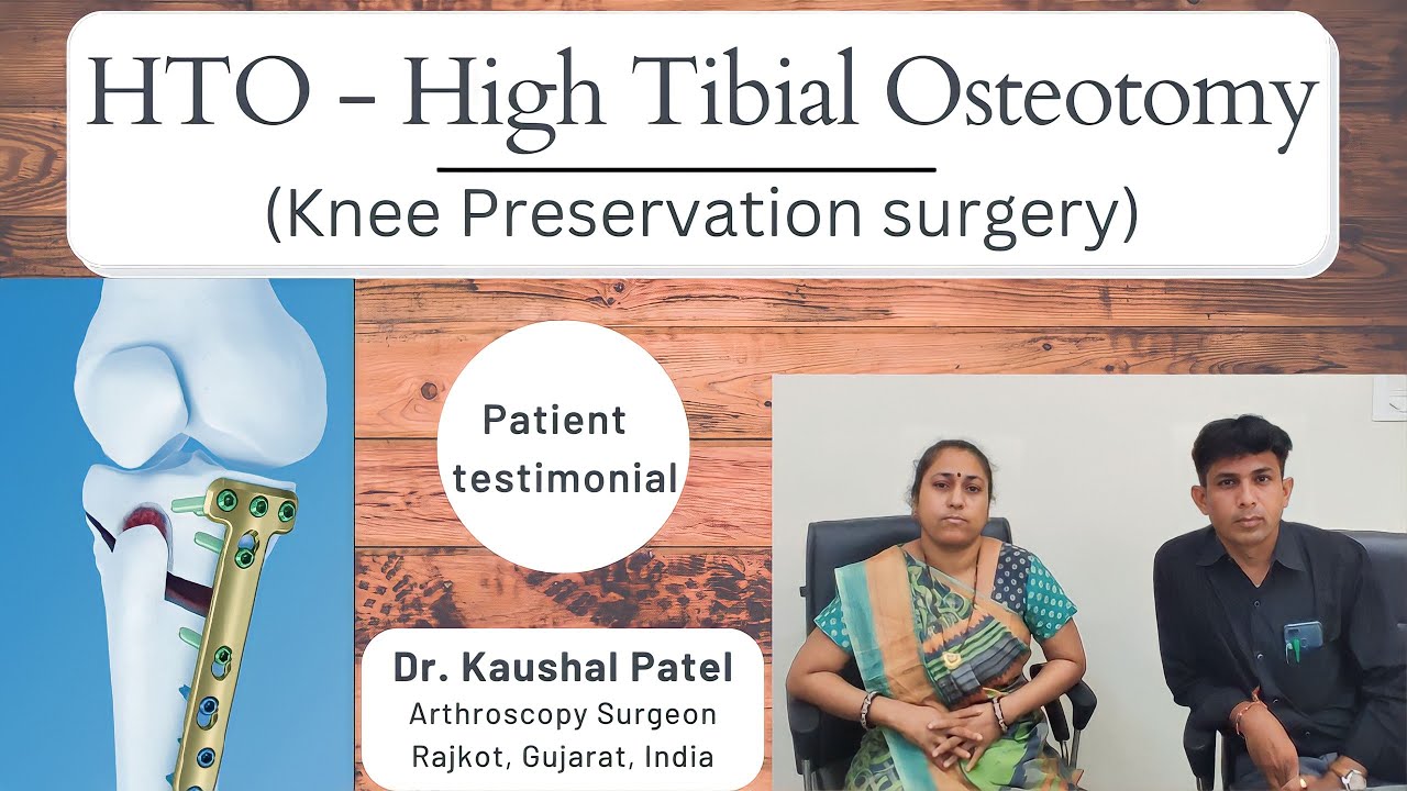 HTO - High Tibial Osteotomy | Joint Preservation Surgery # ...