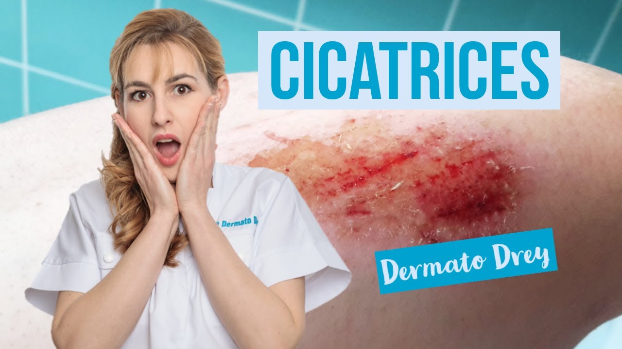 Les cicatrices ! Pourquoi elles se forment, comment les effacer ? # ...