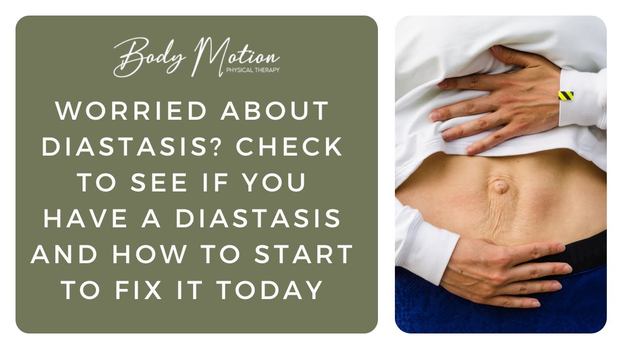 Worried About Diastasis? Check To See If You Have A Diastasis And How ...