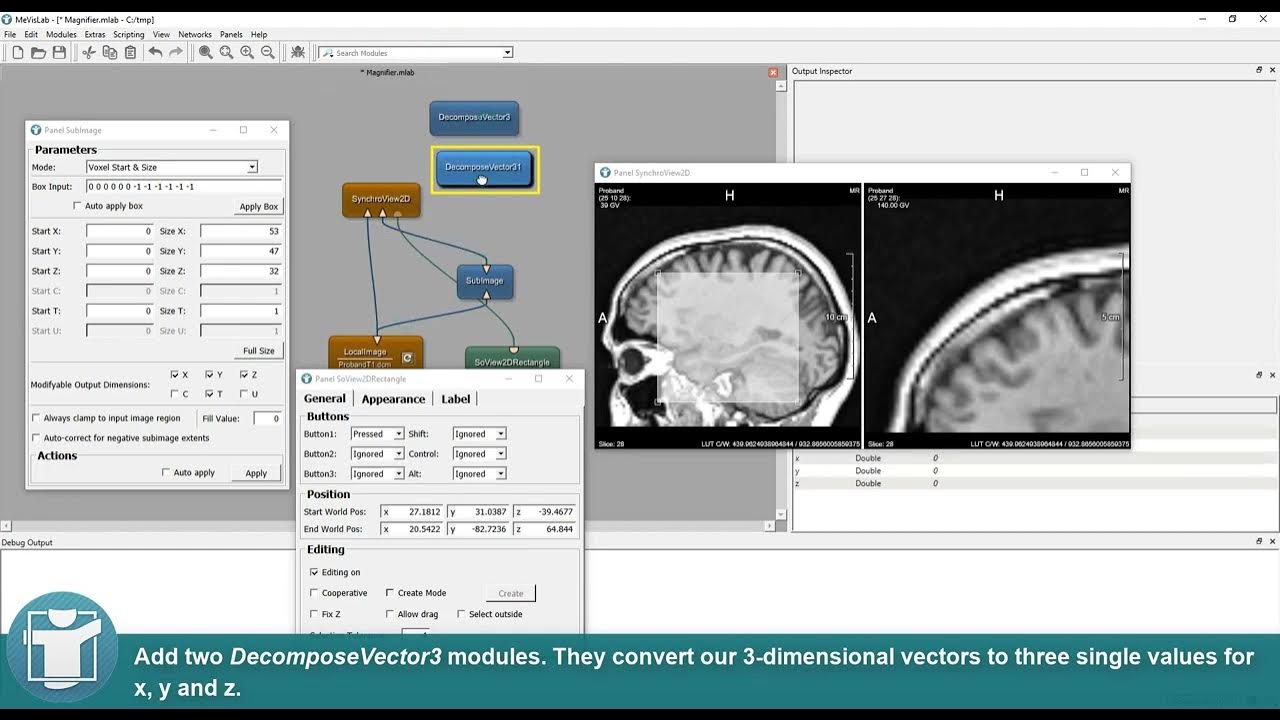 MeVisLab Tutorials - Visualization - Creating a Magnifier - YouTube