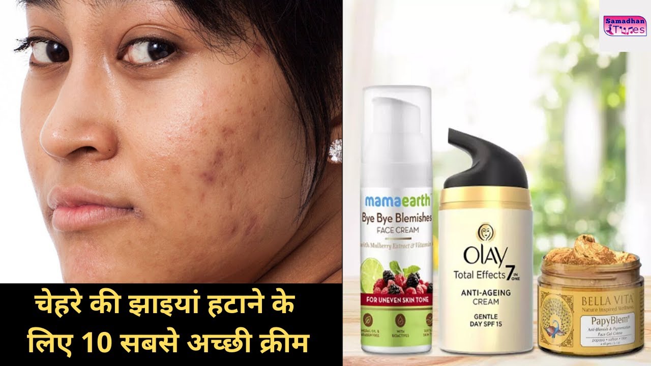 10 Best Pigmentation Removal Cream Pigmentation Remove Best Cream 10-best-pigmentation-removal-cream-pigmentation-remove-best-cream