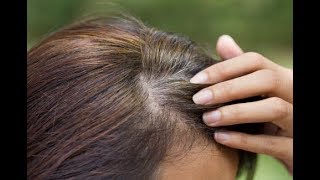 Surprisingly, These Two Things Will Stop Gray Hair In Few Short Days – How To Prevent Gray Hair