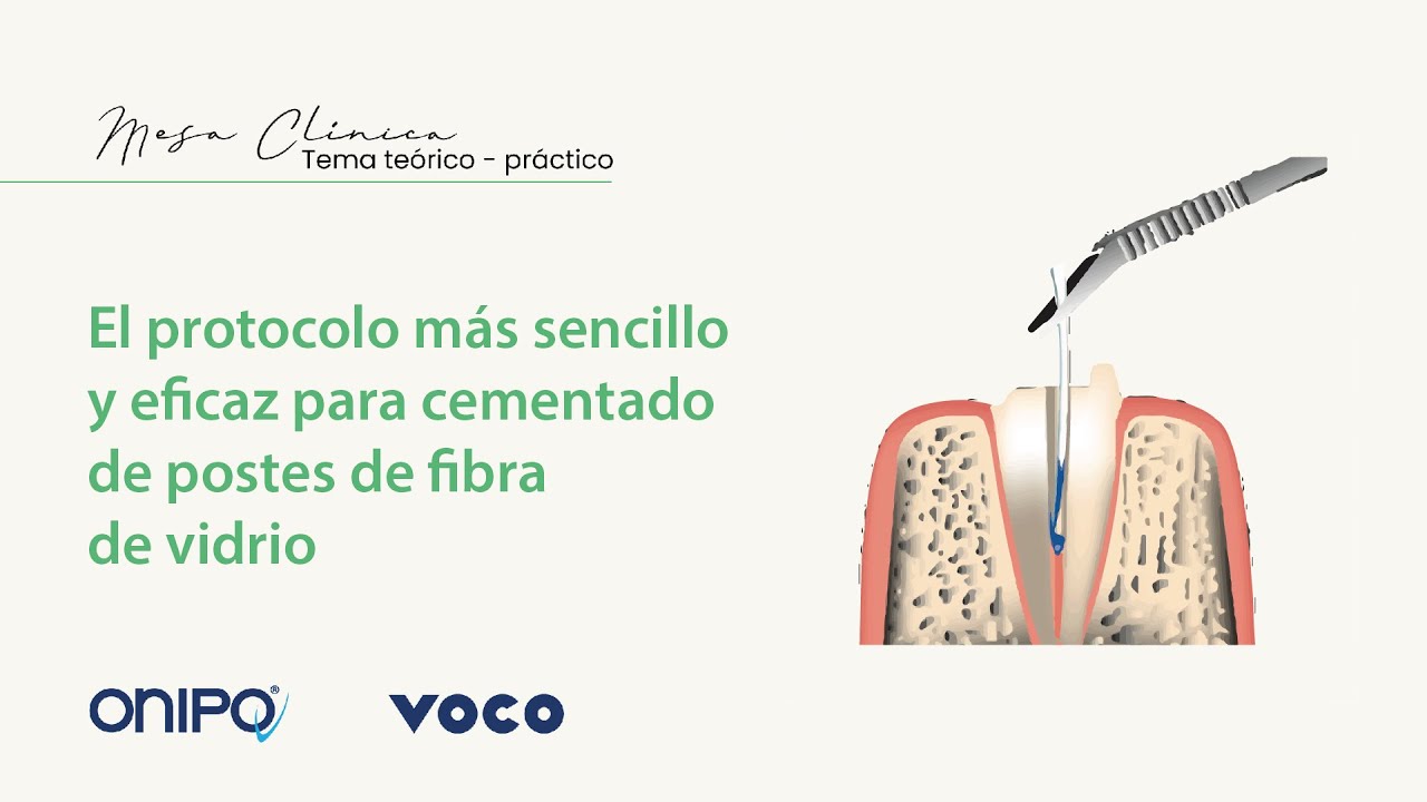 El protocolo más sencillo y eficaz para cementado de postes de fibra de ...