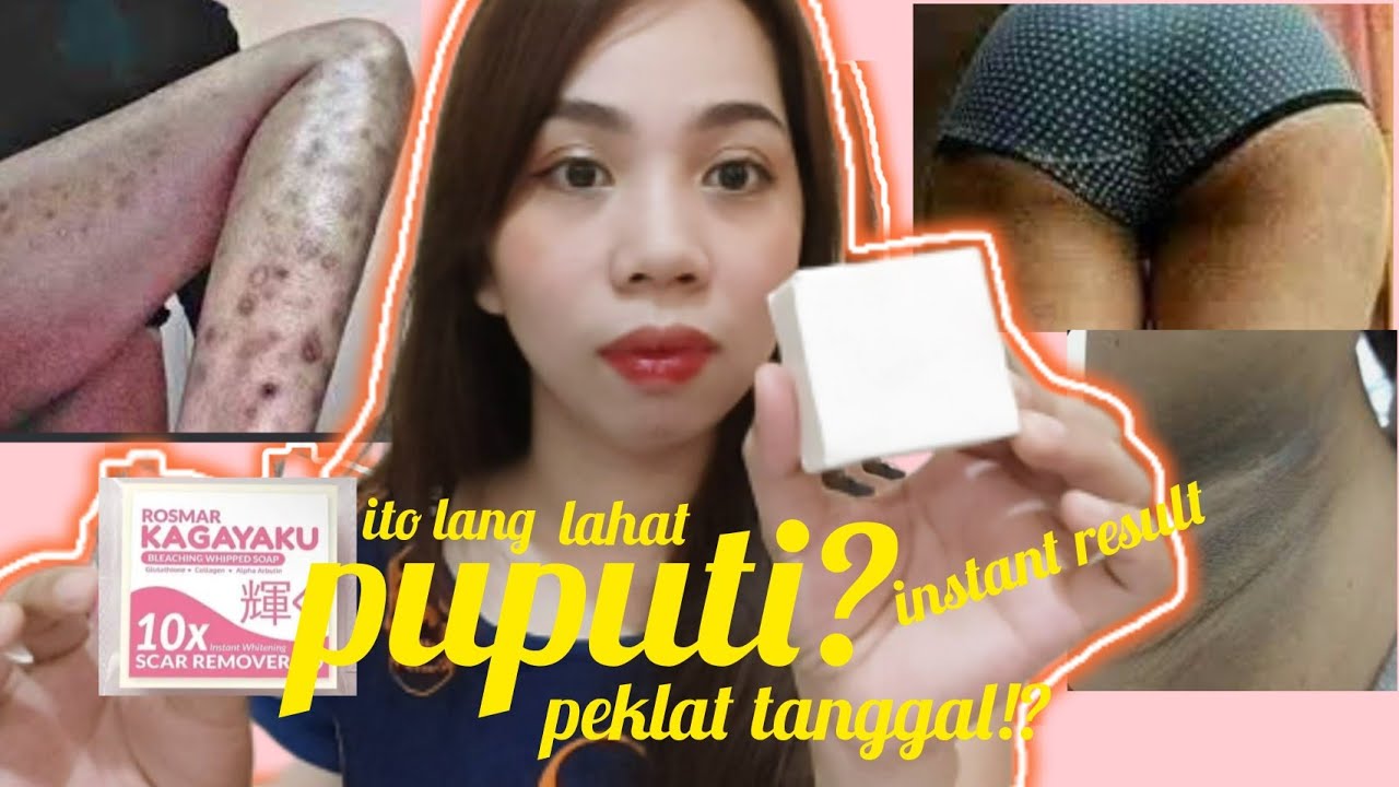 PAMPAPUTI NA PANTANGGAL PEKLAT PA KAGAYAKU BLEACHING WHIPPED SOAP 10X INSTANT WHITENING SCAR pampaputi-na-pantanggal-peklat-pa-kagayaku-bleaching-whipped-soap-10x-instant-whitening-scar