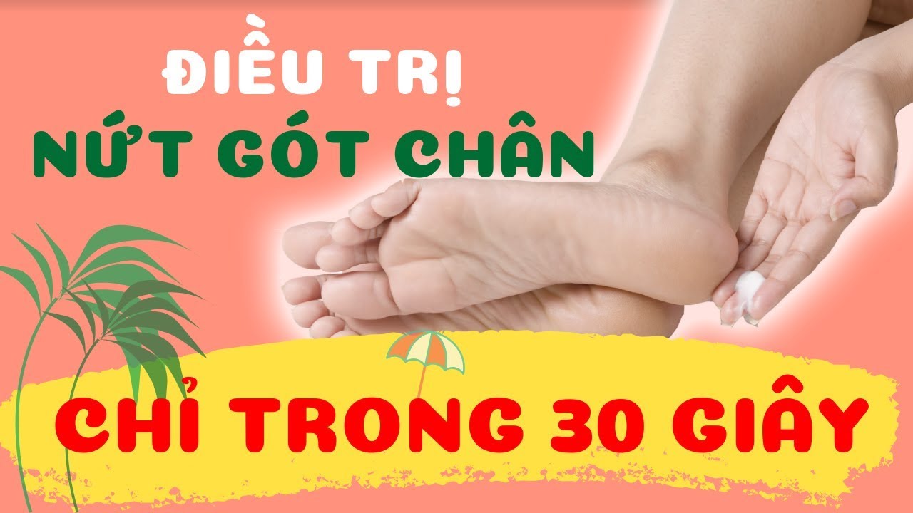 Điều Trị Nứt Gót Chân Tại Nhà Hiệu Quả Chỉ Trong 30 Giây | BÍ KÍP LÀM ...