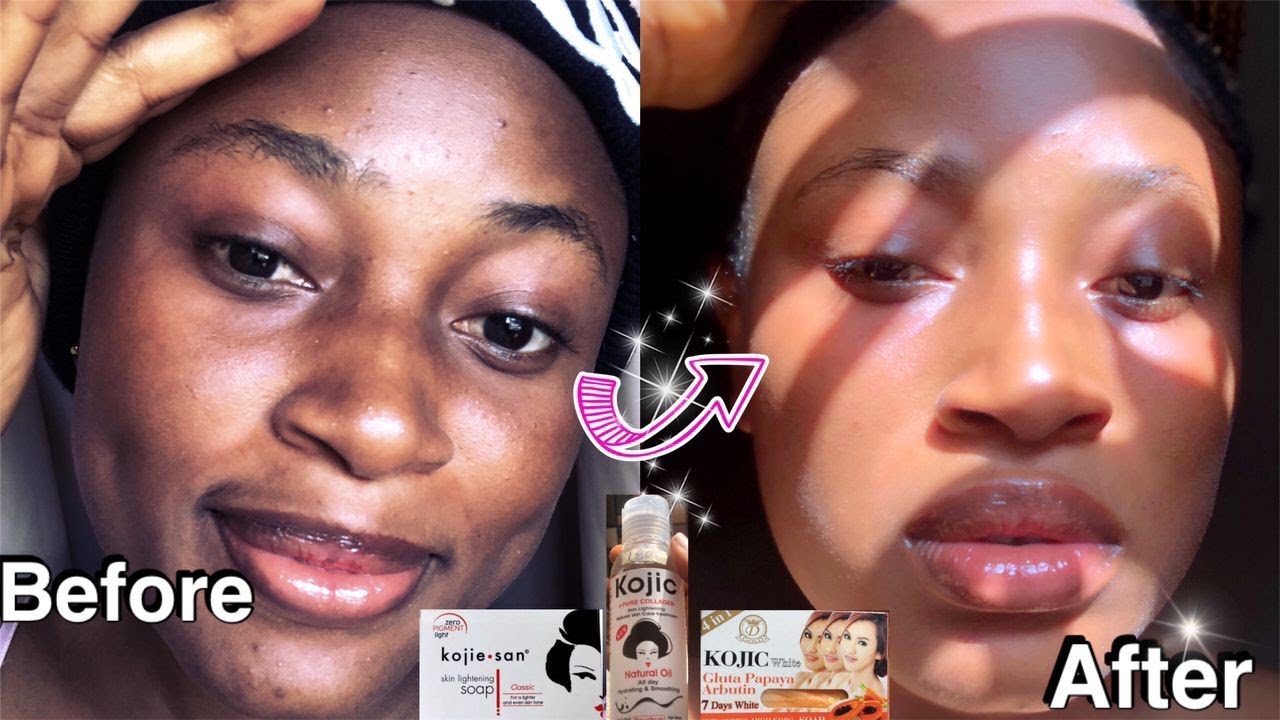 Kojic Acid Before And After 7 Best Kojic Acid Products For Skin In