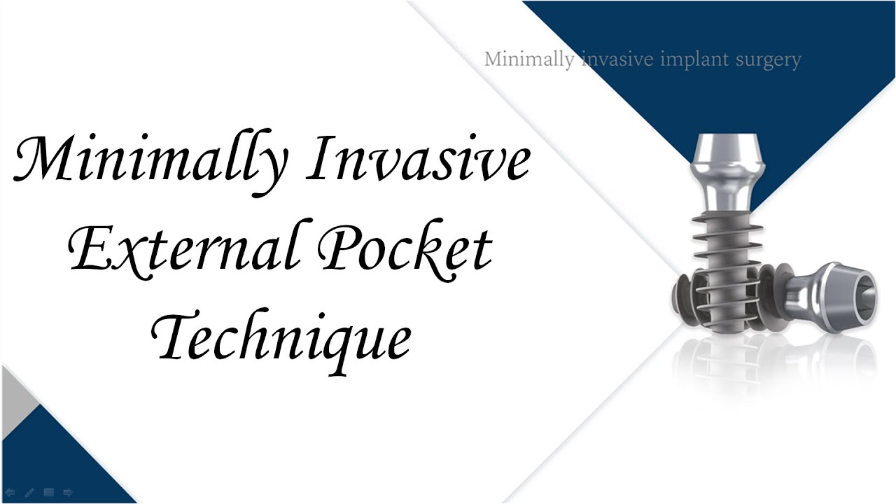 Minimally Invasive External Pocket Technique - YouTube