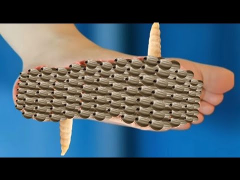 ASMR Treatment Tripophobia Infected Beetle Maggot Foot | ASMR 2d Deep ...