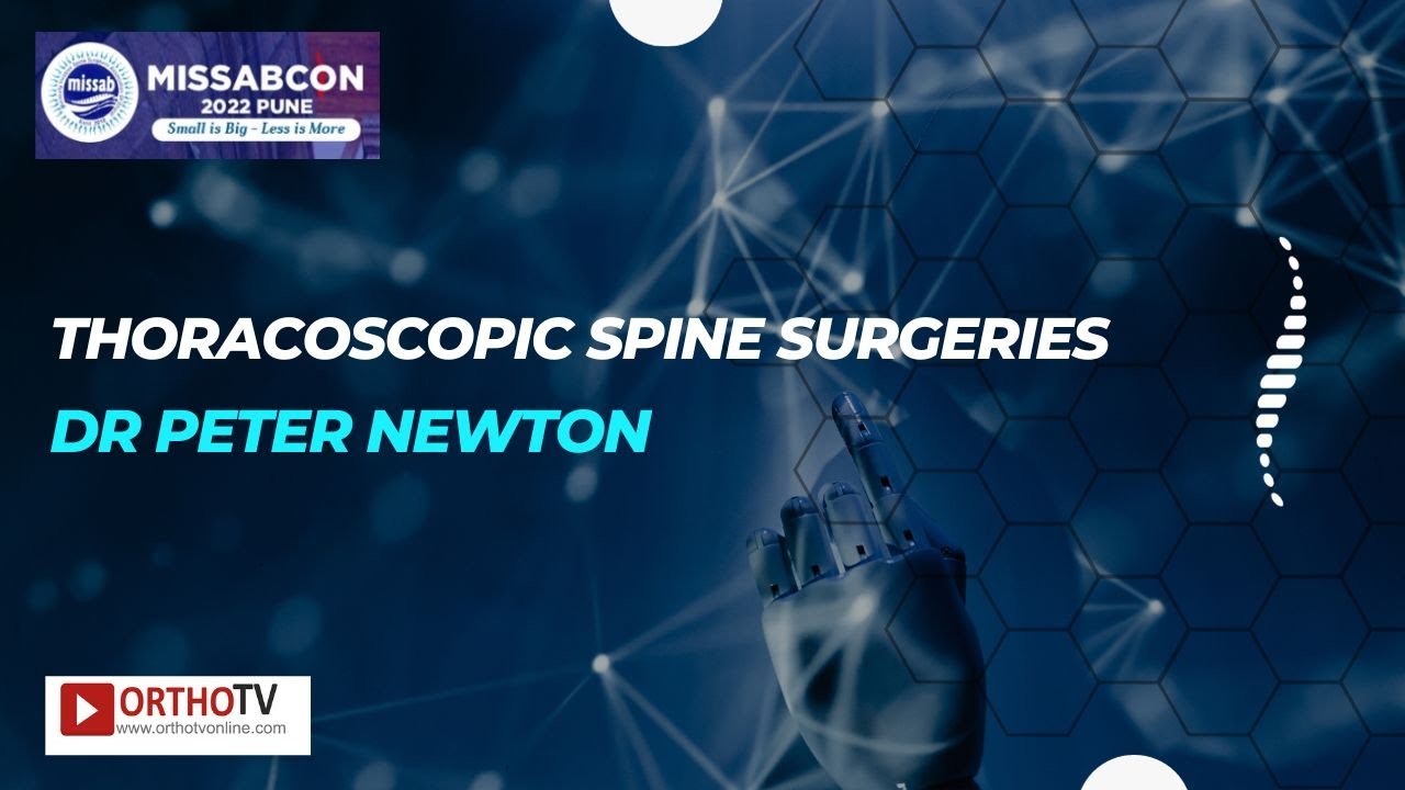 Thoracoscopic Spine Surgeries - Dr Peter Newton - YouTube