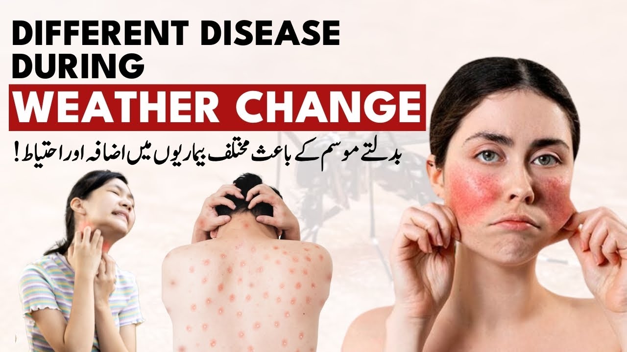 Skin and Other Problems at the Time of Weather Change | Dryness ...