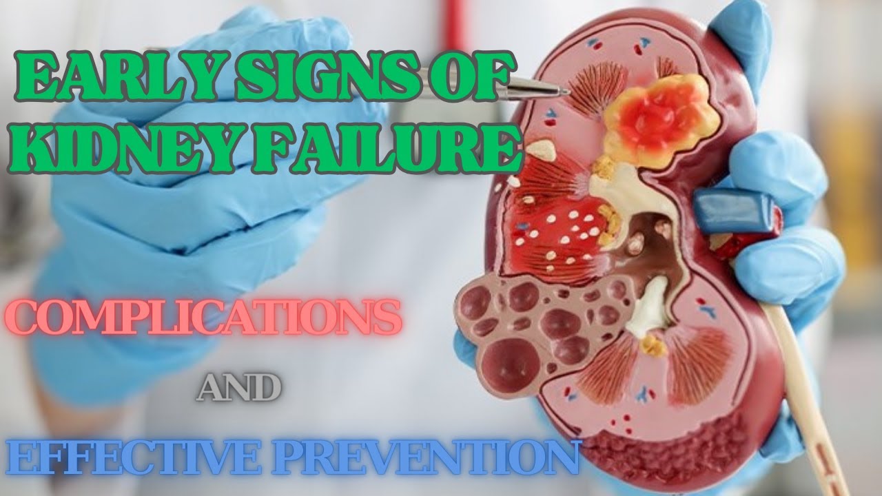 8 EARLY SIGNS OF KIDNEY FAILURE - COMPLICATIONS AND EFFECTIVE ...