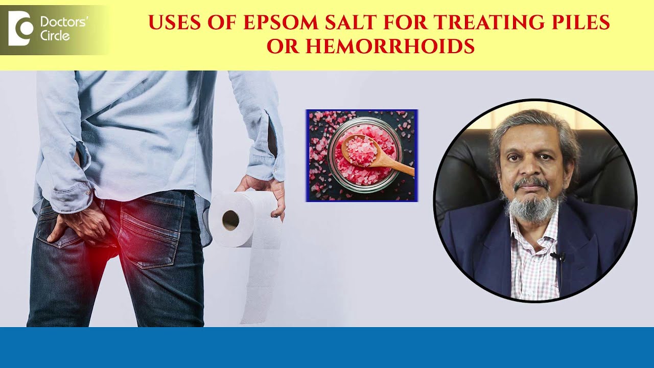 Epsom Salt for management of Piles|Painless Goodbye to Hemorrhoids-Dr ...