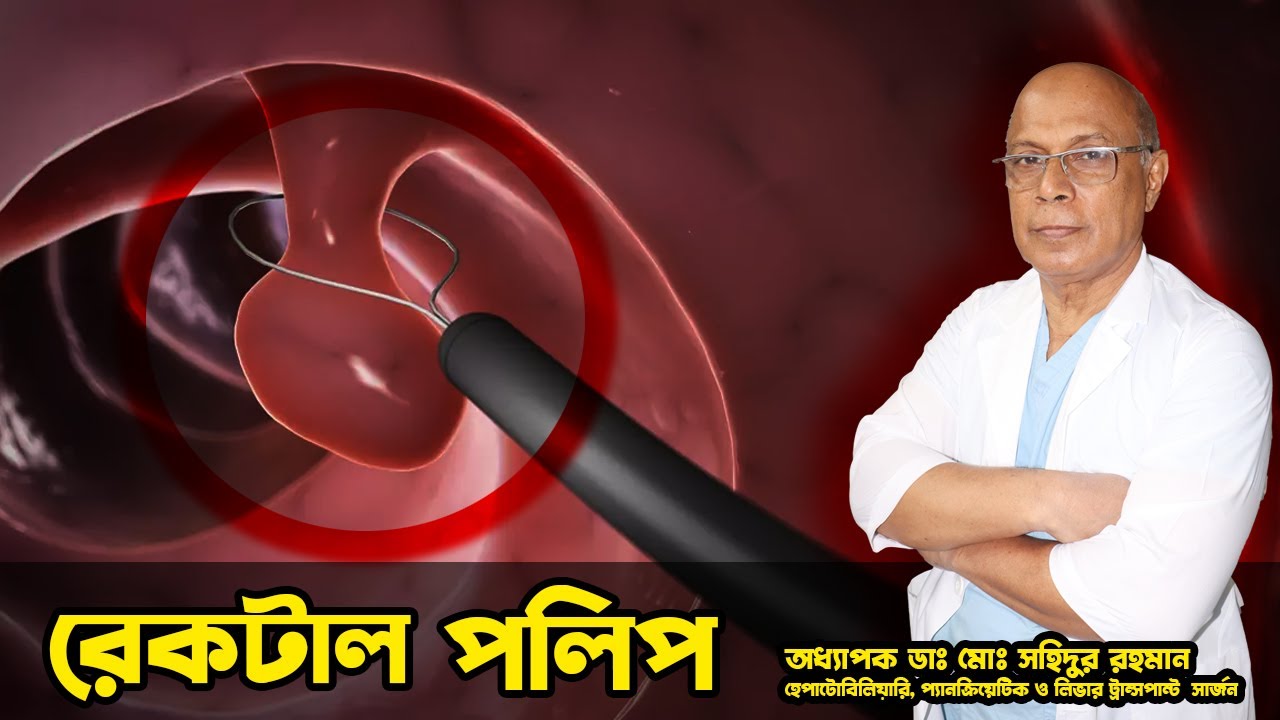 রেকটাল পলিপ। Rectal polyps। Are rectal polyps serious? অধ্যাপক ডাঃ মোঃ সহিদুর রহমান।LGSH - YouTube