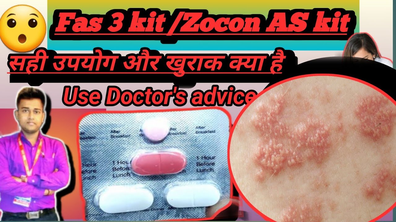Zocon AS kit | Zocon AS kit ke fayde | Zocon AS kit uses in hindi/Fas 3 ...