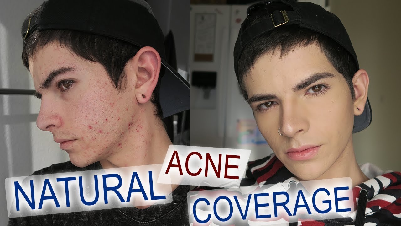 Drugstore Acne Coverage Foundation Routine | NON-CAKEY Natural for Men ...