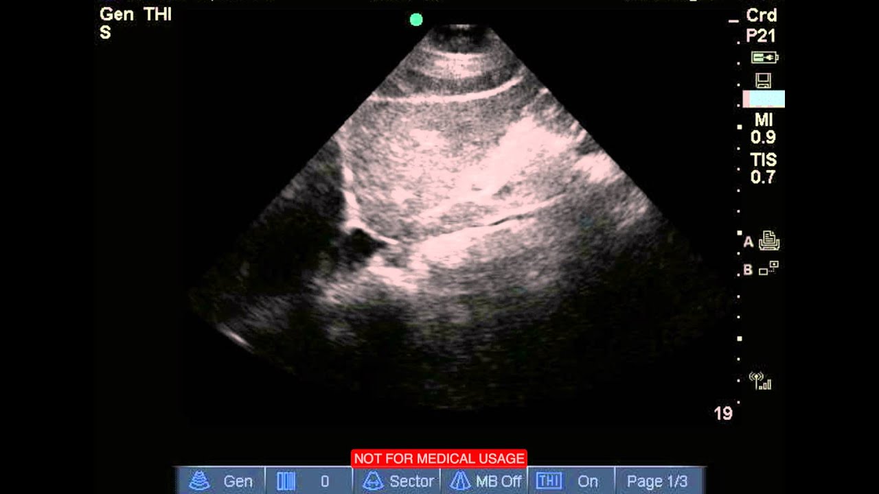 ivc flat, kissing - YouTube