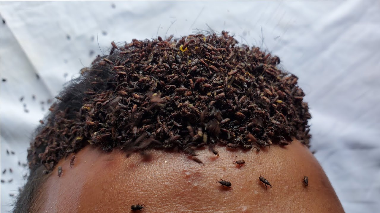 Remove lice on sad boy's head #002 - YouTube