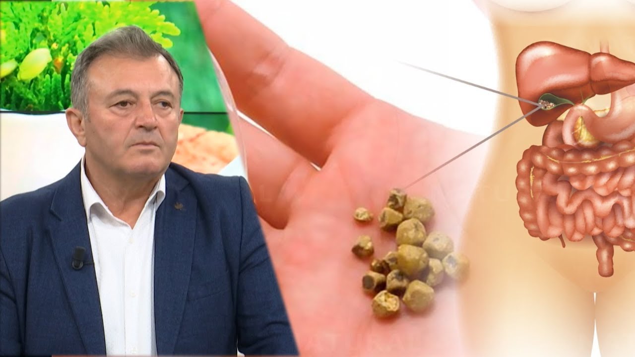 Keni gurë në tëmth? Ja çfarë duhet të bëni për të shpëtuar njëherë e ...