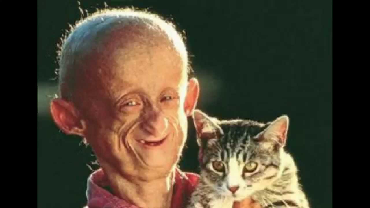 Ten Most Bizarre Medical Anomalies - YouTube