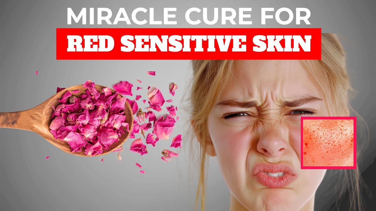 How I Cured My Red Sensitive Skin - YouTube