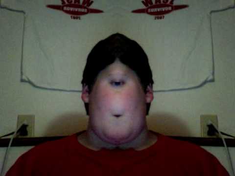 one eyed retard - YouTube