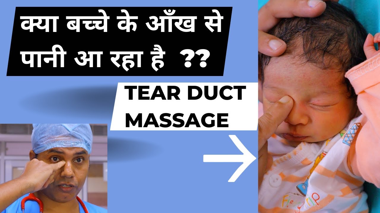 क्या आपके बच्चे की आँखों से पानी आ रहा है? | Sticky eyes | Lacrymal ...