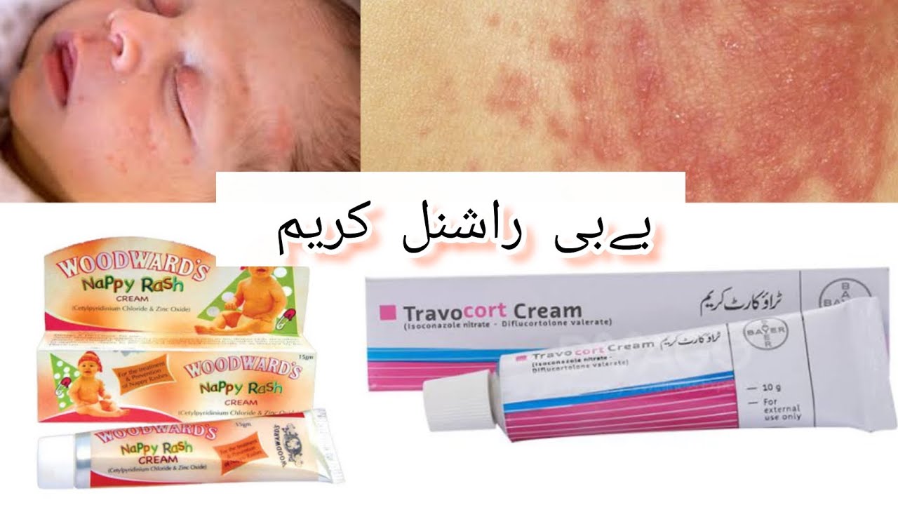 What's The Best Baby Rash Cream at Scott Sommer blog