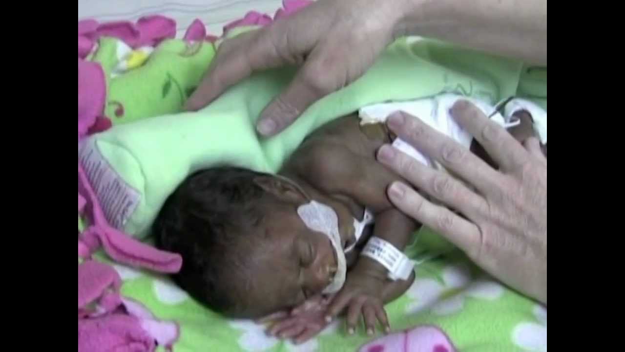 Right Sidelying Position / Positioning NICU patients with The Zaky ...