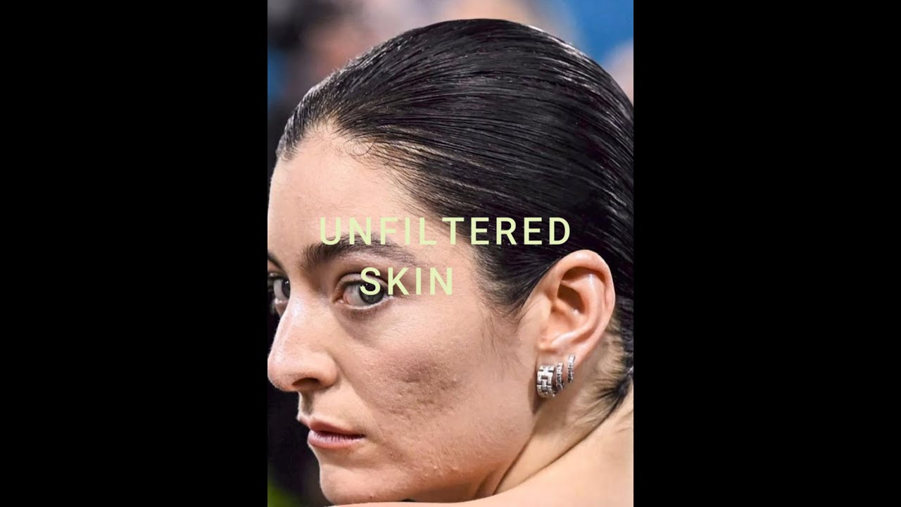 Textured Skin is Normal — Even Celebs Have It! - YouTube