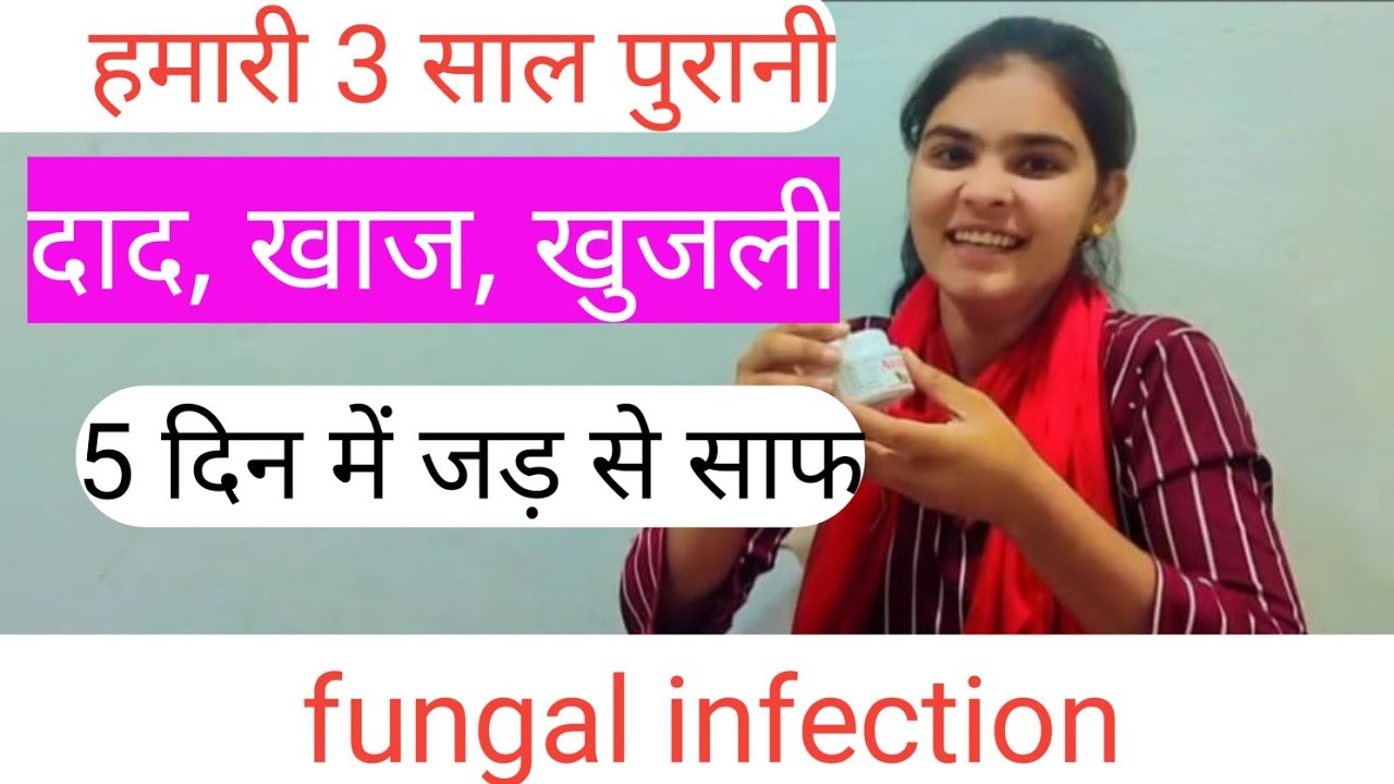 दाद खाज खुजली की क्रीम | fungal infection cream | daad khujli ki dawa ...