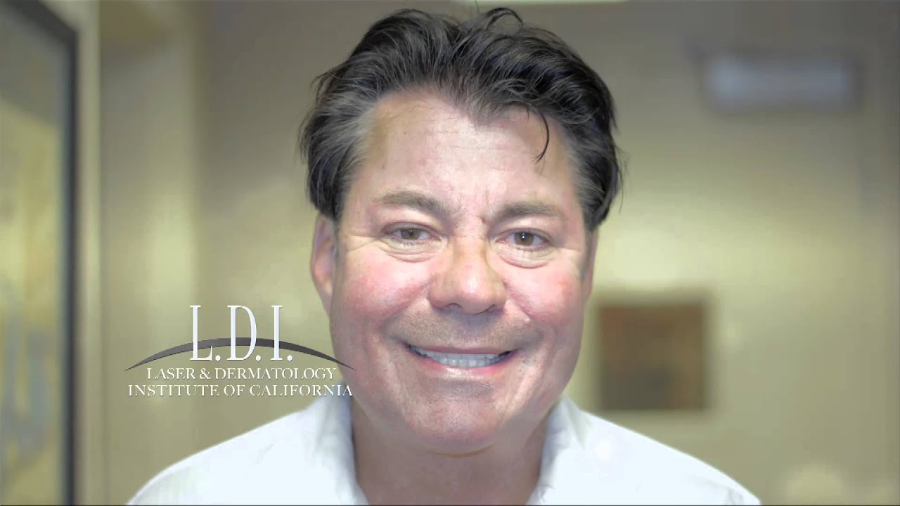 LDI Laser - Non-Surgical Face Lift - Patient Review #3 - Dr. Rispler ...