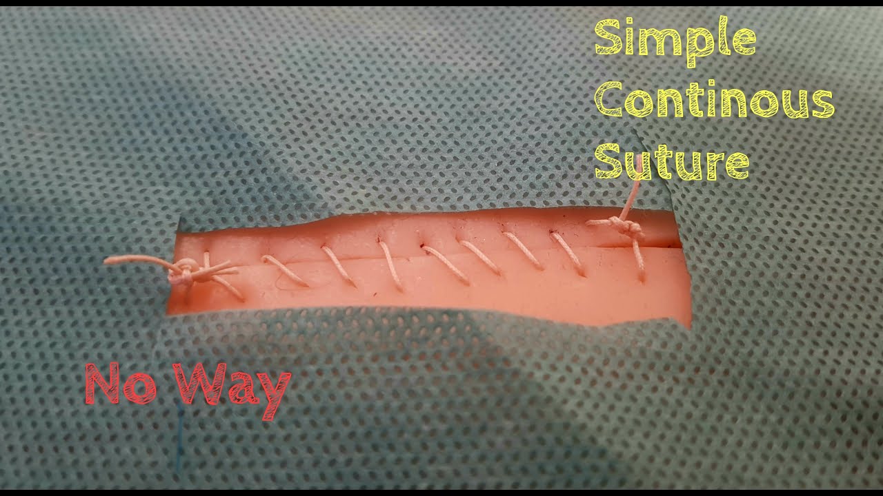 Simple Continuous Suture. Continuous Patterns - YouTube