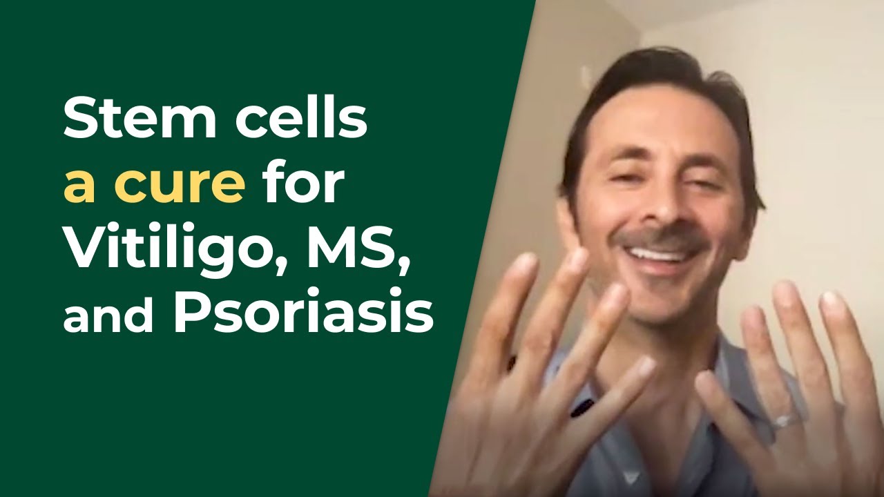 One Patient's Victory: Stem Cells for Treating Vitiligo and 3 More ...