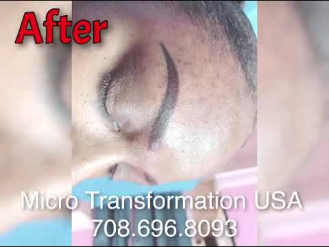 Ombre Shading! Wow, @Micro Transformation USA completely transformed ...