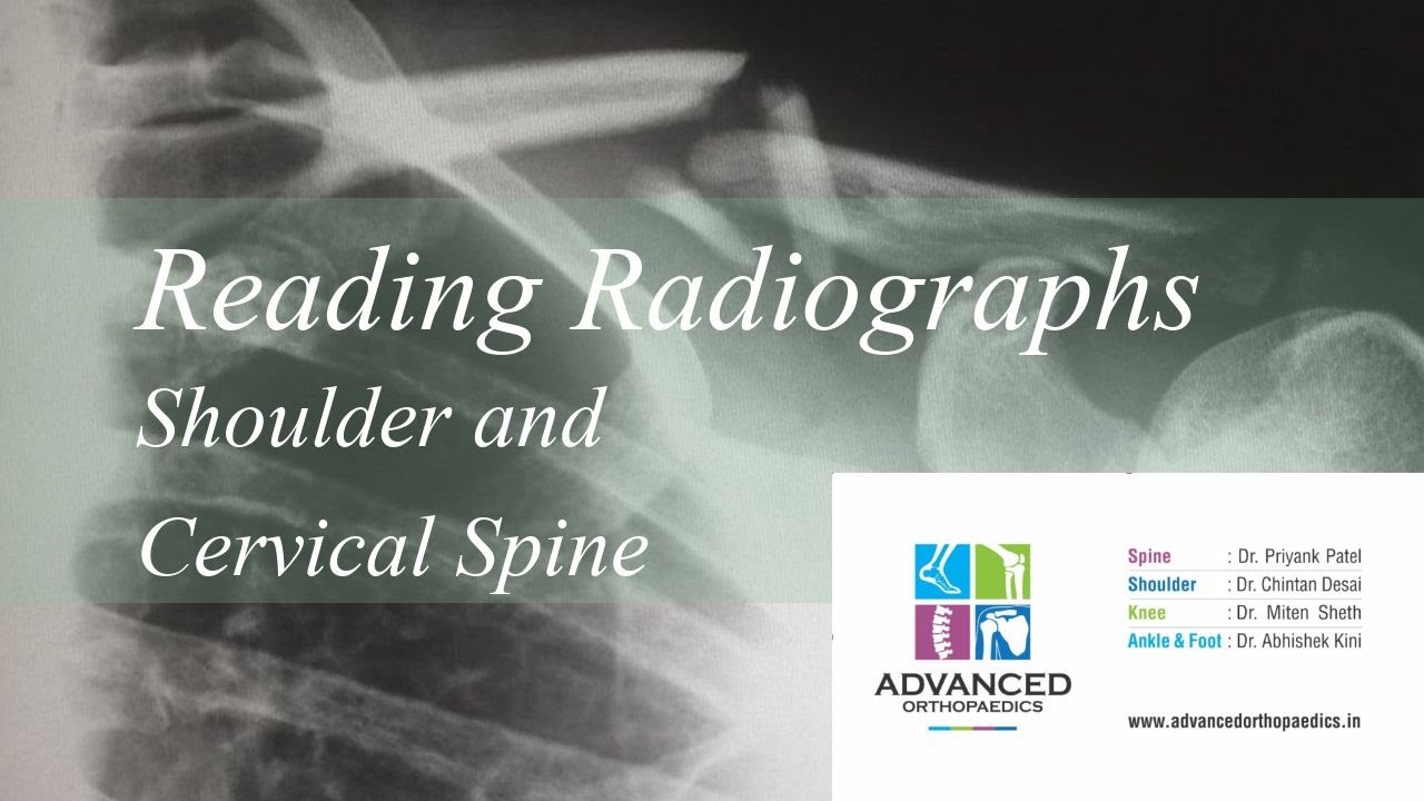 Reading x-ray films of the Shoulder and Cervical Spine - YouTube