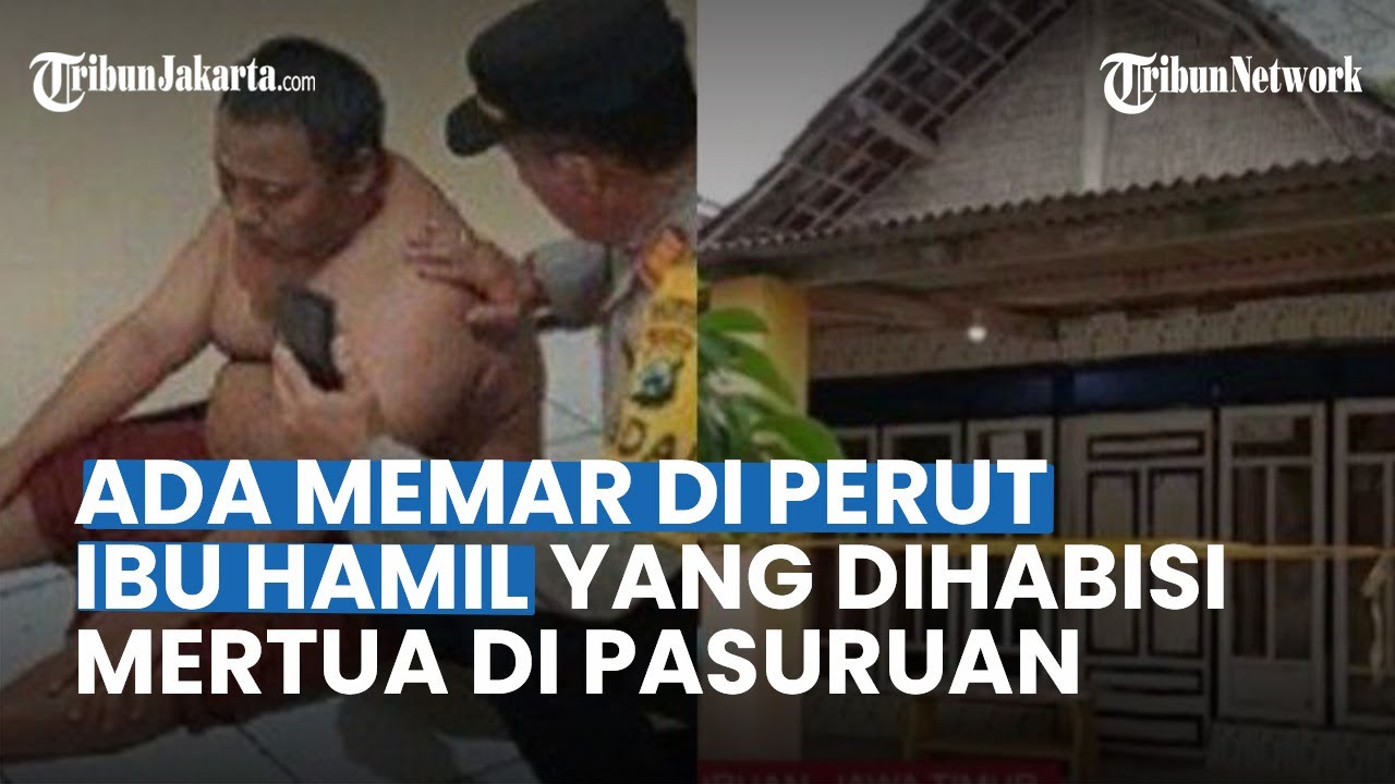 MIRIS Jasad Ibu Hamil yang Dibunuh Mertua di Pasuruan Memar-memar di ...