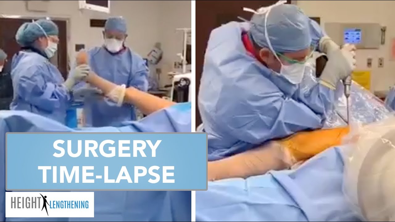 Limb Lengthening Surgery Time-Lapse with Dr. Mahboubian | Inside the OR ...