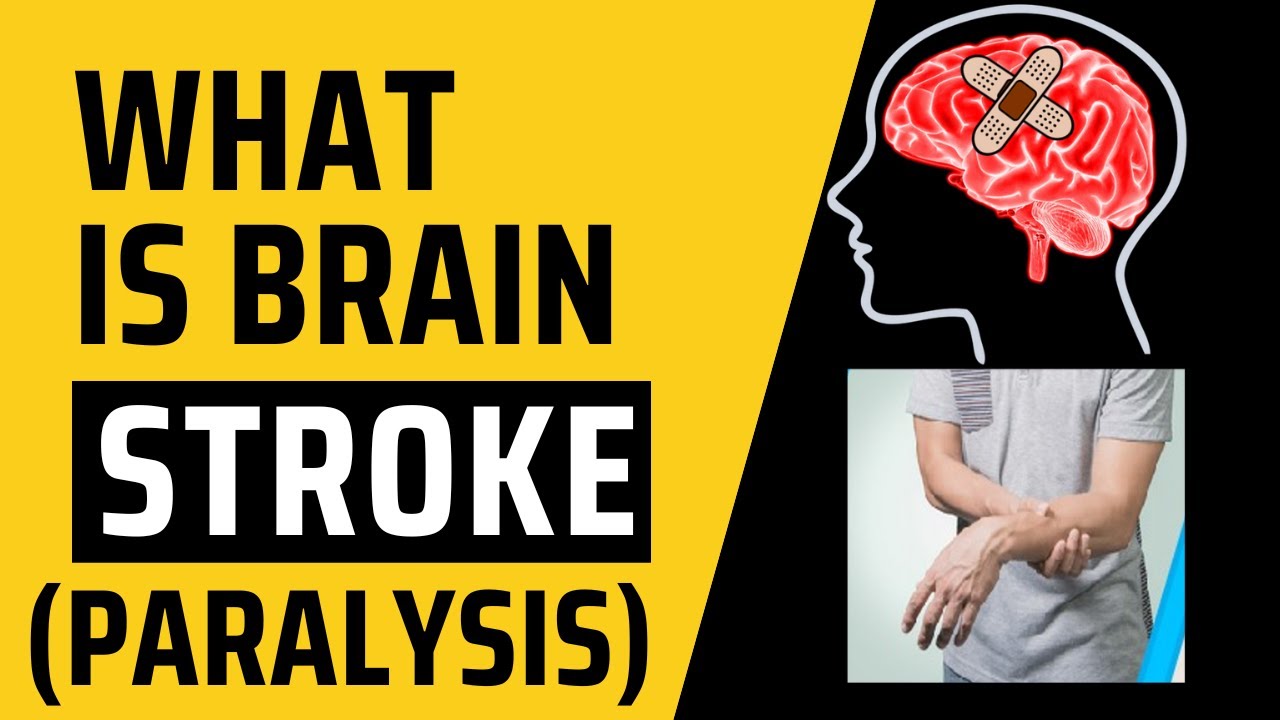 what is stroke | Paralysis | Lakva | brain clot| Dr. Harsha KJ | Best ...