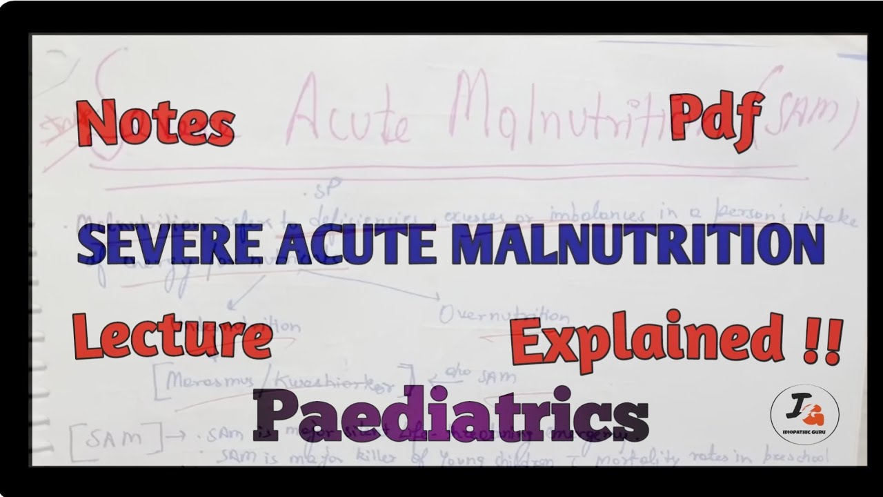 Severe Acute Malnutrition (SAM) Pediatrics - YouTube
