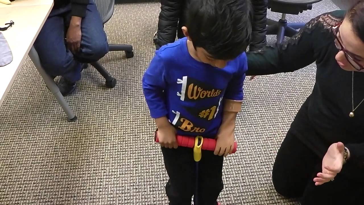 Electric Hand Helps 4-Year-Old Draw, Play, Smile - YouTube